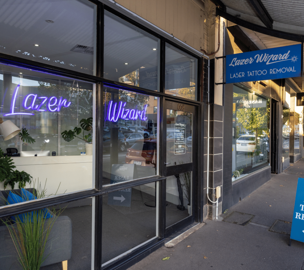 About Us | Lazer Wizard